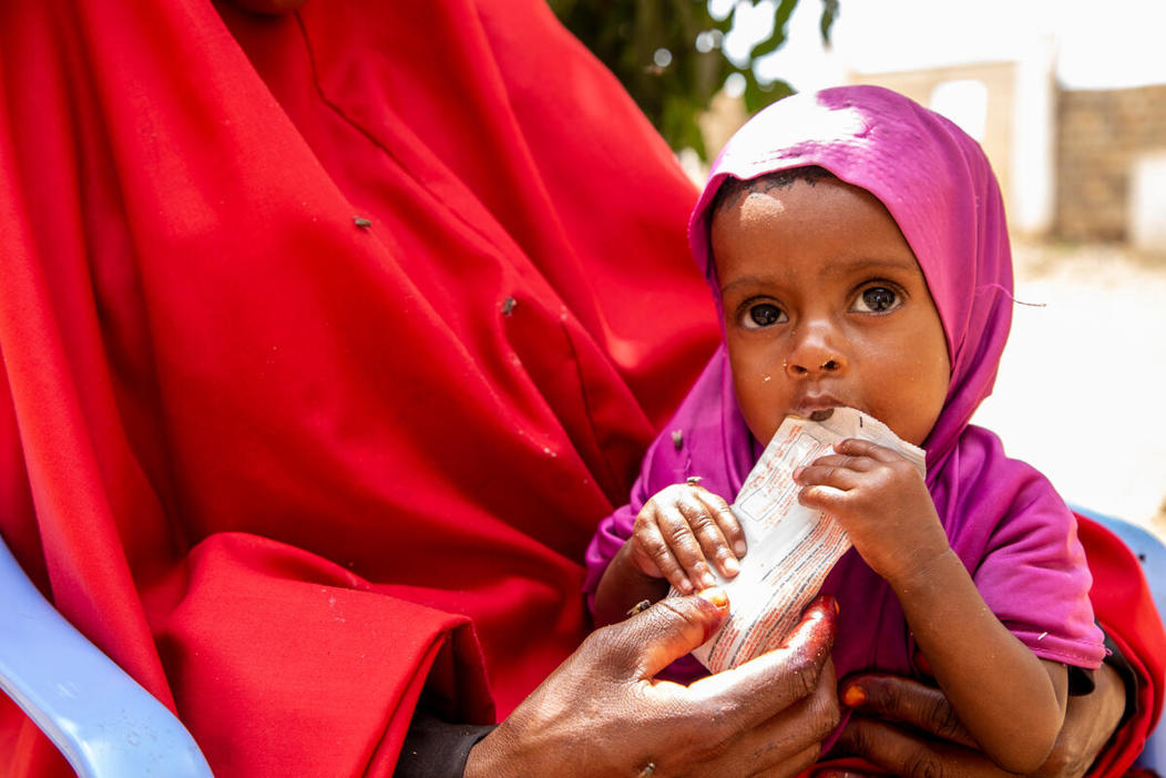 Children's Hunger & Malnutrition Charity | World Vision UK